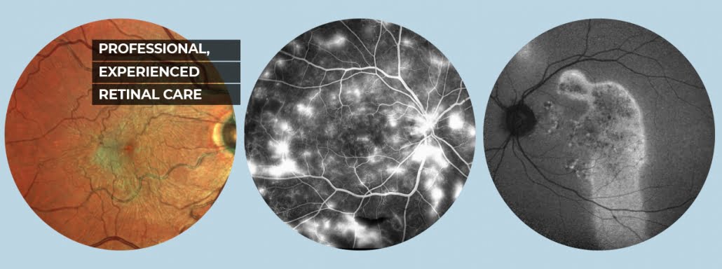 Central Triad Retina - Caring For Retina Injuries and Illnesses