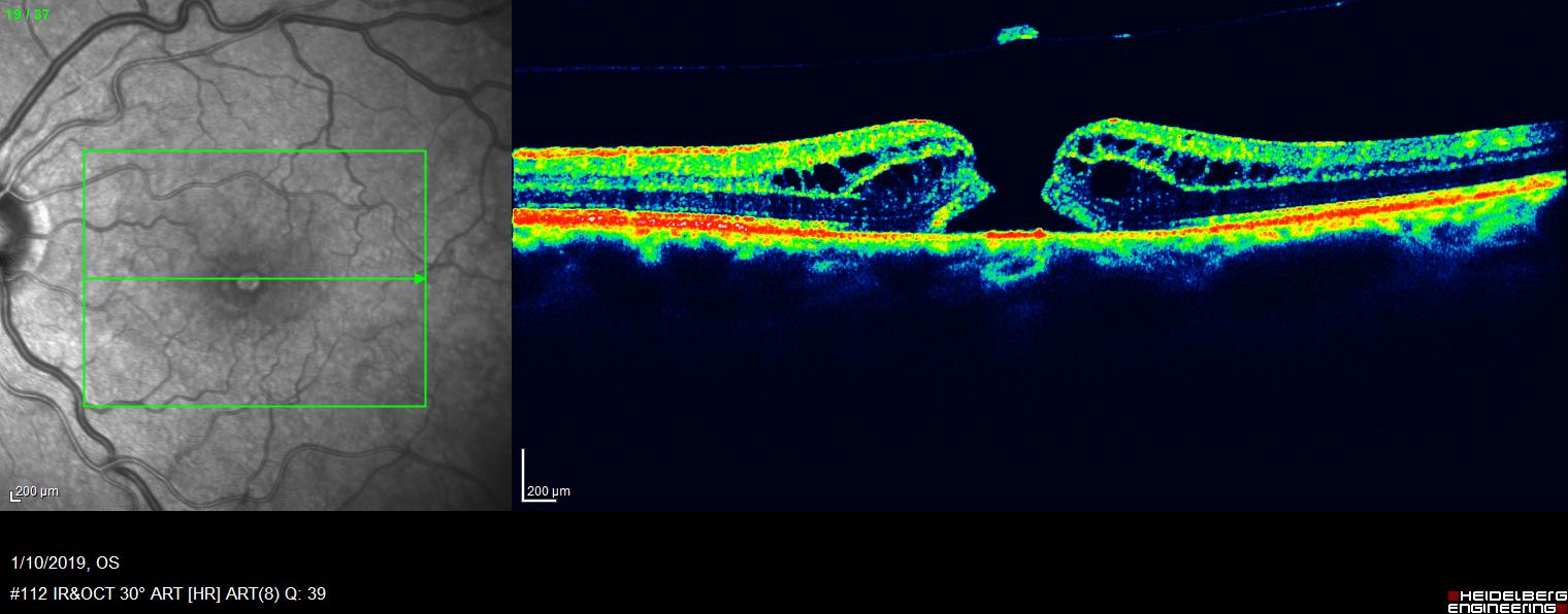 Services - Central Triad Retina Serves Patients From Two Locations